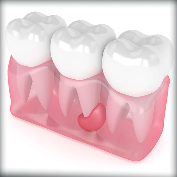 Oral Surgery Newmarket | Newmarket Oral & Maxillofacial Surgery